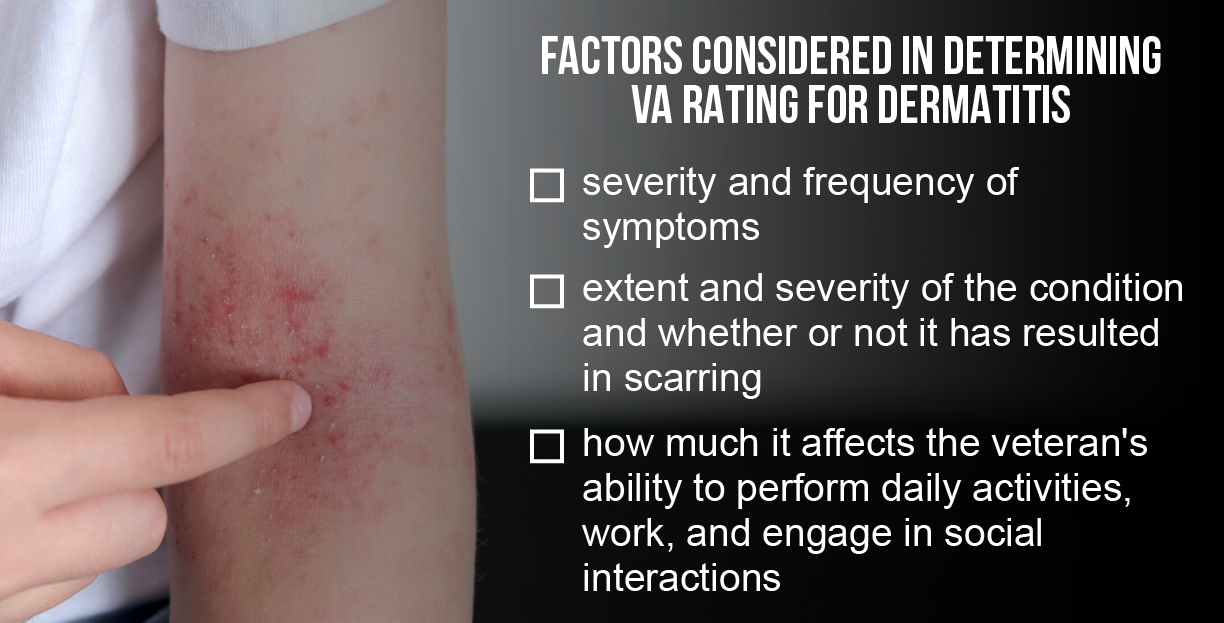 How do Skin Conditions Get Rated by the VA? - VET CLAIM SOLUTIONS