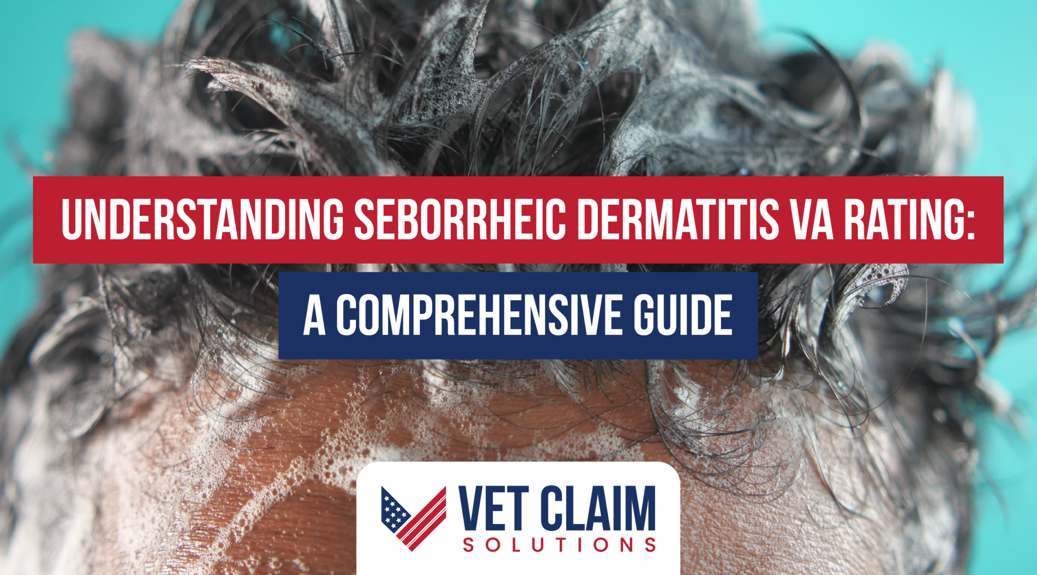 Understanding Seborrheic Dermatitis VA Rating: A Comprehensive Guide ...